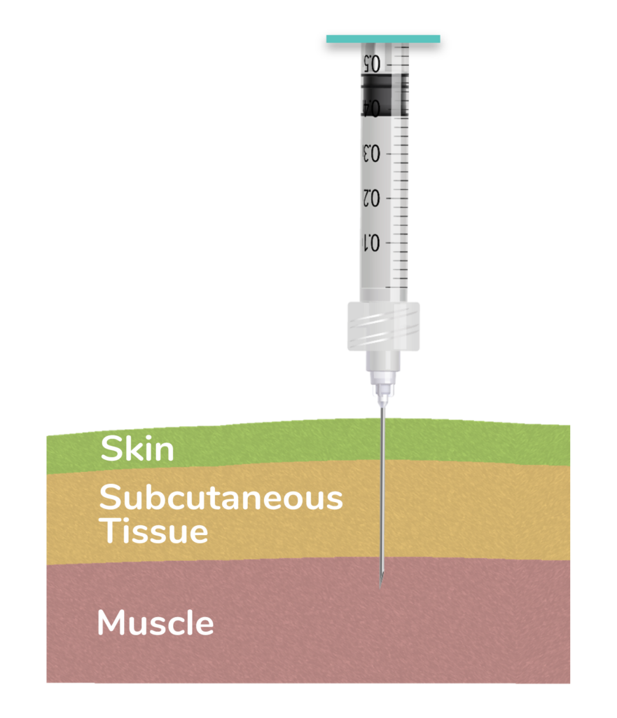 Patients Prefer Implantable Pellets for Low-T - menMD