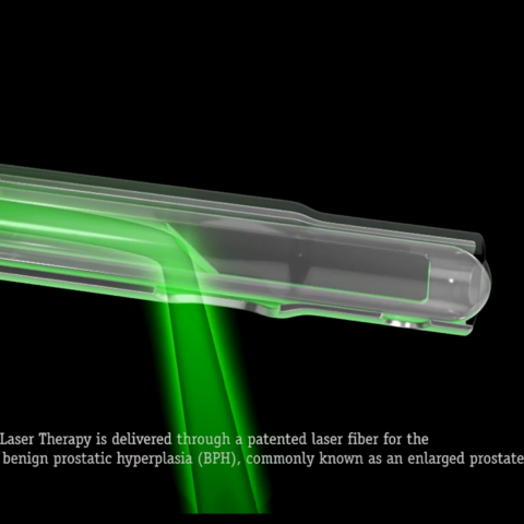 Boston Scientific GreenLight™ Laser Therapy - menMD